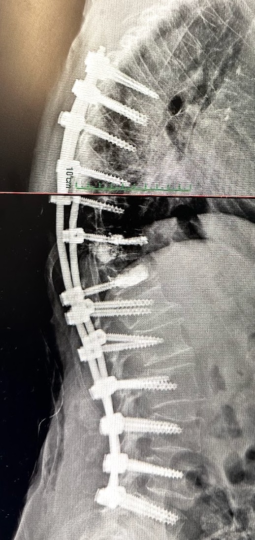Gallery - Orthonext Lainate poliambulatorio Ortopedia vertebrale e ...